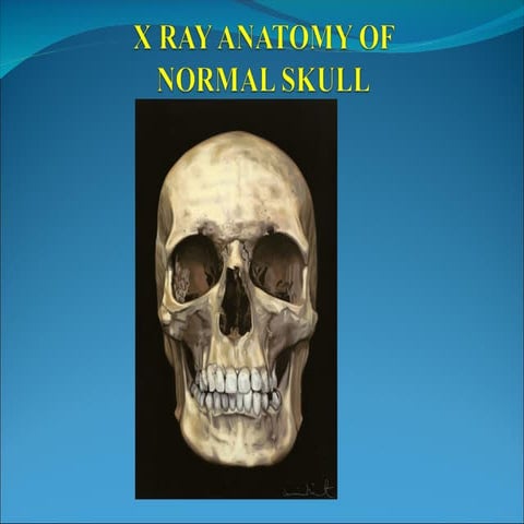 X RAY ANATOMY OF NORMAL SKULL.ppt heiejehehueh | PPT