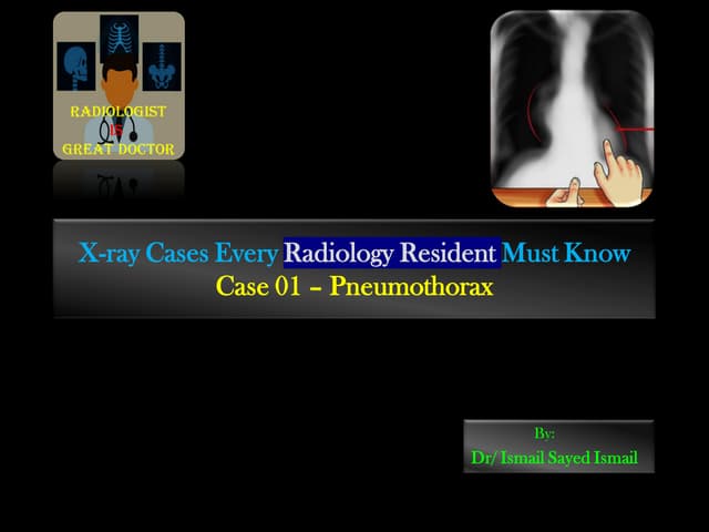 abdominal x ray radiology | PPTX