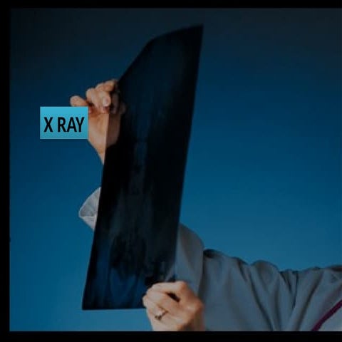 x ray class in final year mbbs for practical examination | PPTX