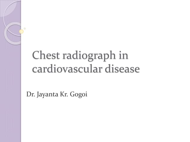 Normal chest Xray: Fundamentals and Basic Interpretation (By Dr ...