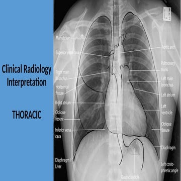 Essential Radiographic Views of chest....pdf