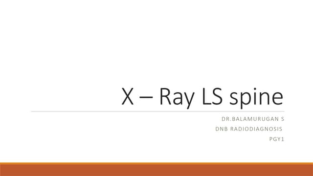 Transitional vertebrae radiology | PPTX