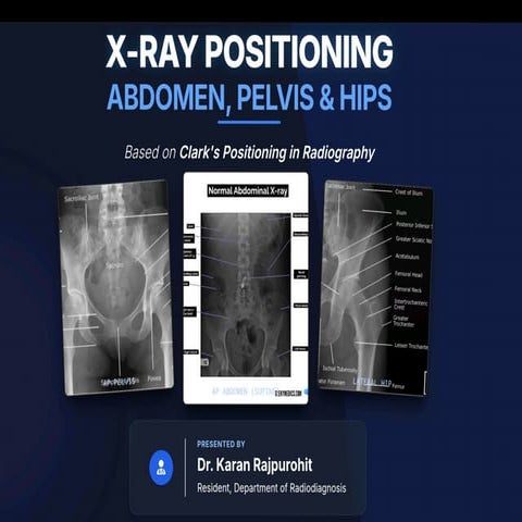 XRAY POSITIONING ABDOMINAL HIPS AND PELVIS by Dr Karan Rajpurohit.pptx