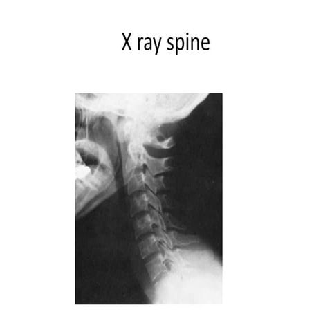 X_RAY_SPINE.pptx