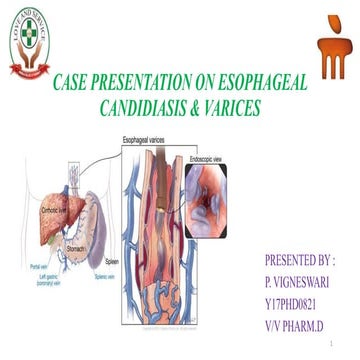 Esophageal Candidiasis