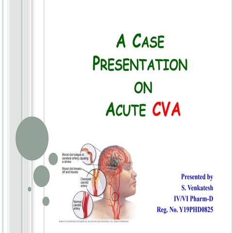 Case presentation on CVA.pptx