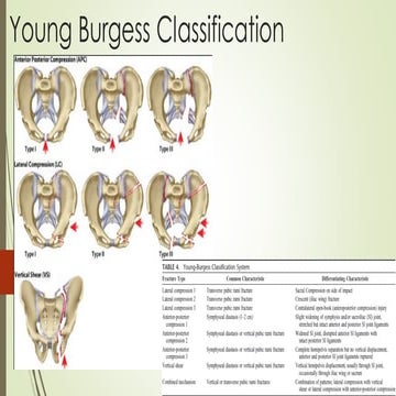 Young Burgess Classification PELVIC KAM.pdf