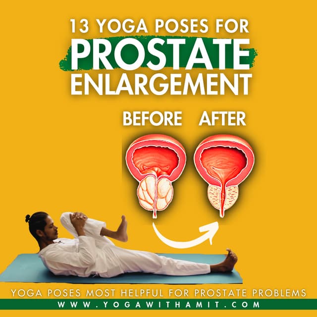 Yoga for Prostate | PDF | Reproductive Health | Diseases and Conditions