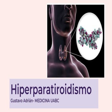 Hiperparatiroidismo Endocrinología y medicina | PPTX