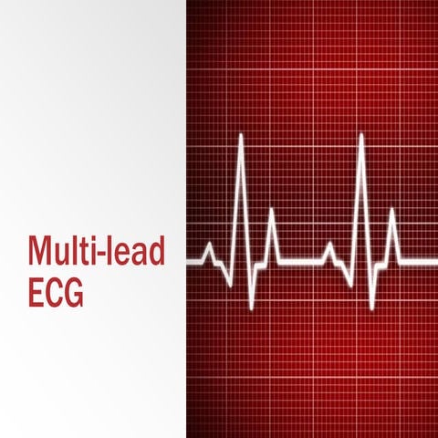 TCAD - Multi-lead ECG | PPSX