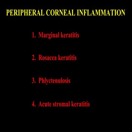 13 peripheral corneal inflam | PPT