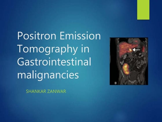 Positron Emissions Tomography (PET SCAN) | PPTX