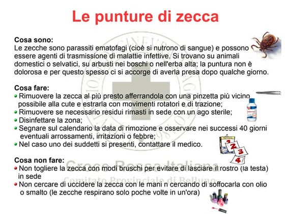 Punti di compressione | ODP