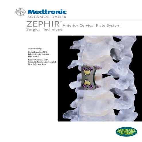 Zephir | PDF
