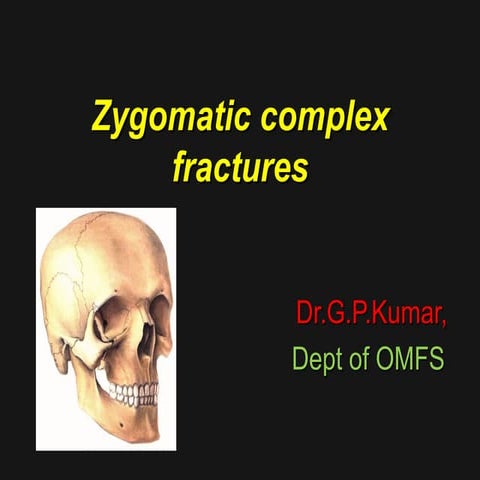 Zmc fracture..by Dr.GPK/ Dr.G.P.Kumar/Dr.G.Padmanabha Kumar | PPT