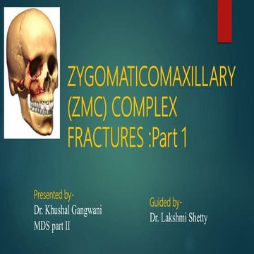 Zmc fractures part 1 | PPTX