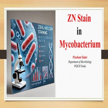 Ziehl-Neelsen Stain: Principle, Procedu. | PDF