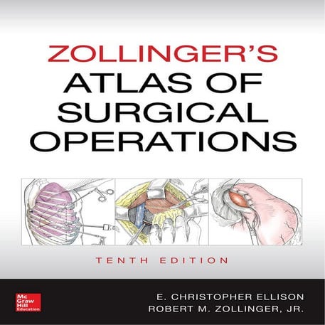 Zollinger’s Atlas of Surgical Operations-McGraw-Hill (2016).pdf