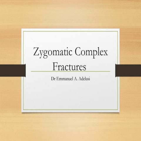 Zygomatic arch fracture | PPTX